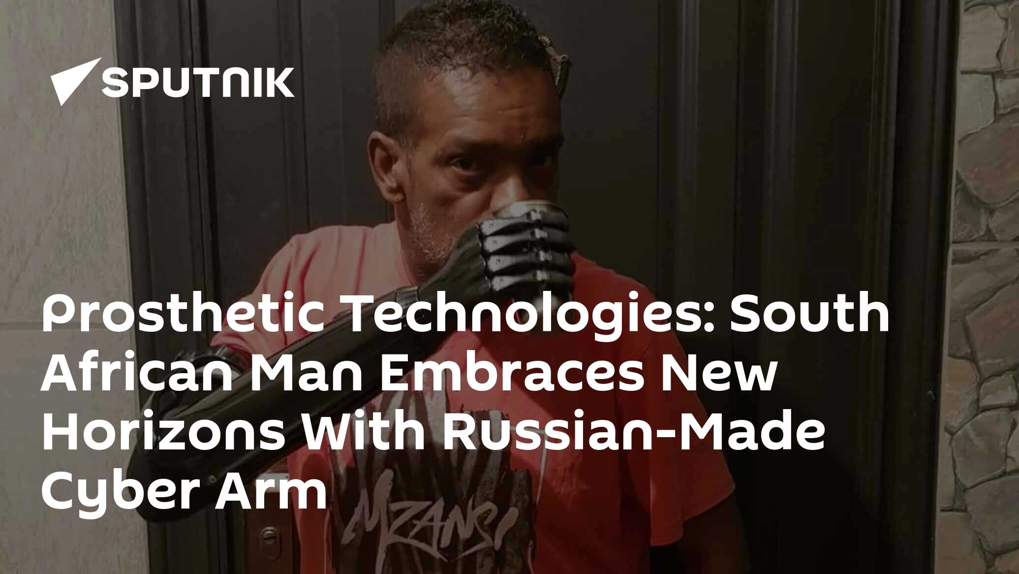 Prosthetic Technologies: South African Man Embraces New Horizons With ...