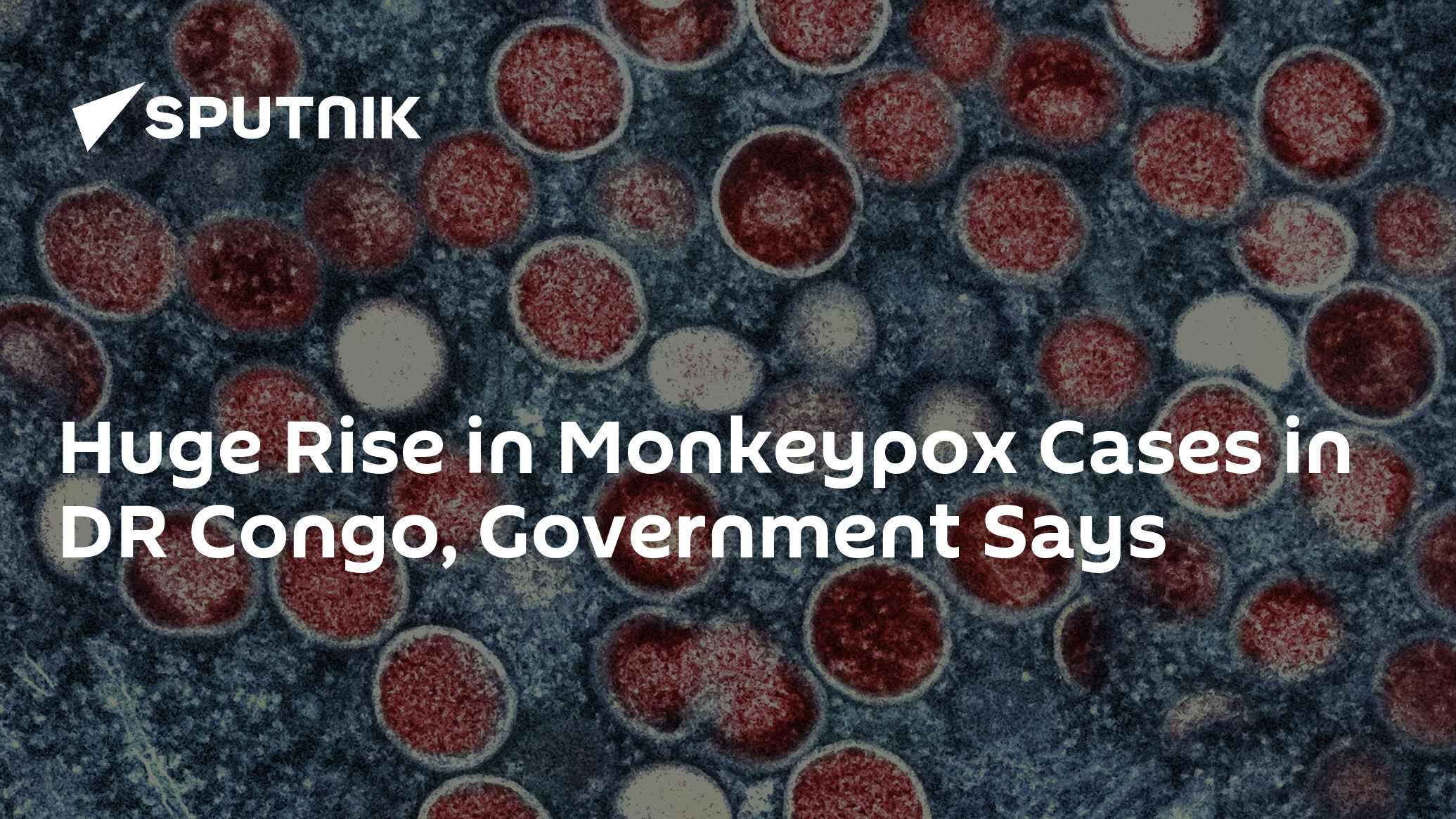 Huge Rise in Monkeypox Cases in DR Congo, Government Says - 20.07.2024 ...