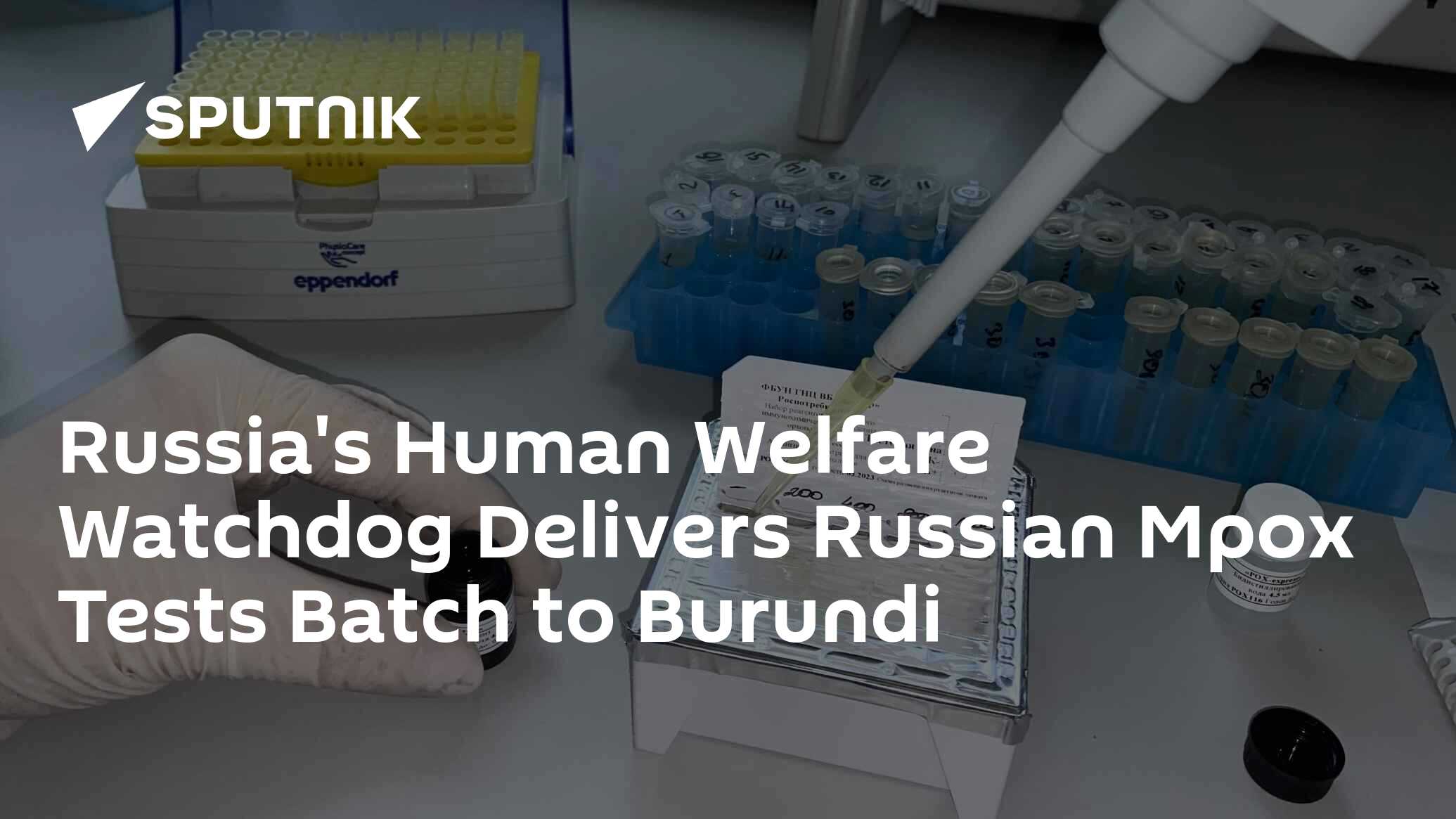 Russia's Human Welfare Watchdog Delivers Russian Mpox Tests Batch to ...