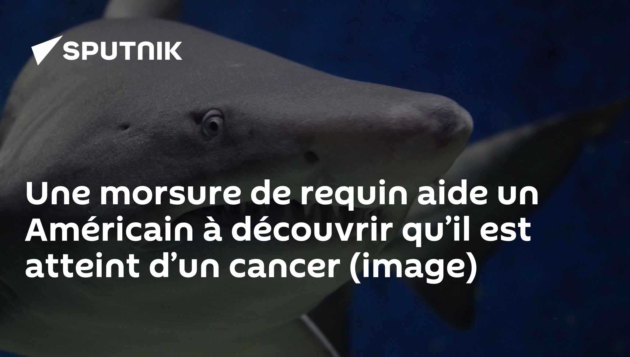 Une morsure de requin aide un Américain à découvrir qu’il est atteint d ...