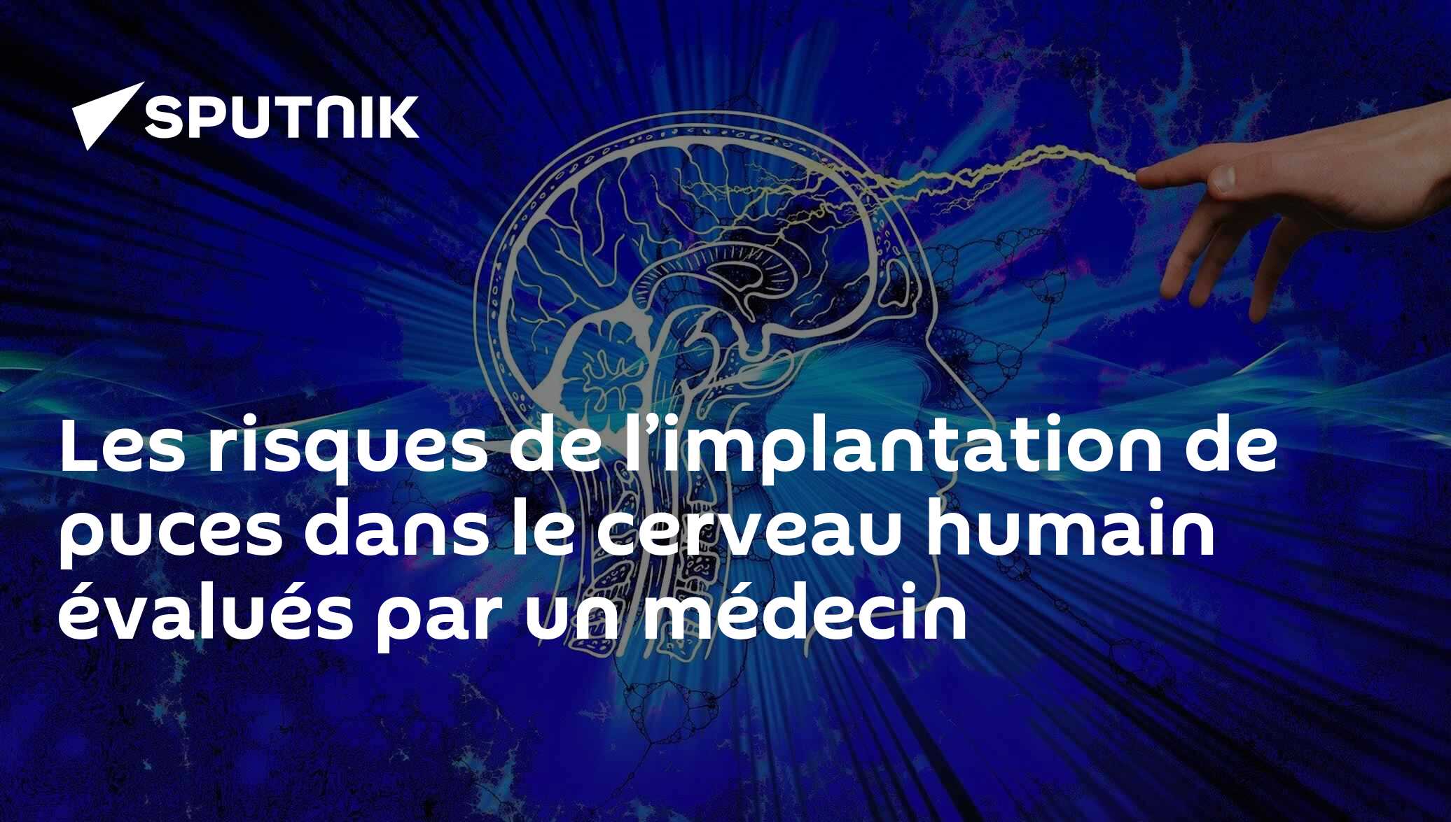 Les risques de l’implantation de puces dans le cerveau humain évalués ...